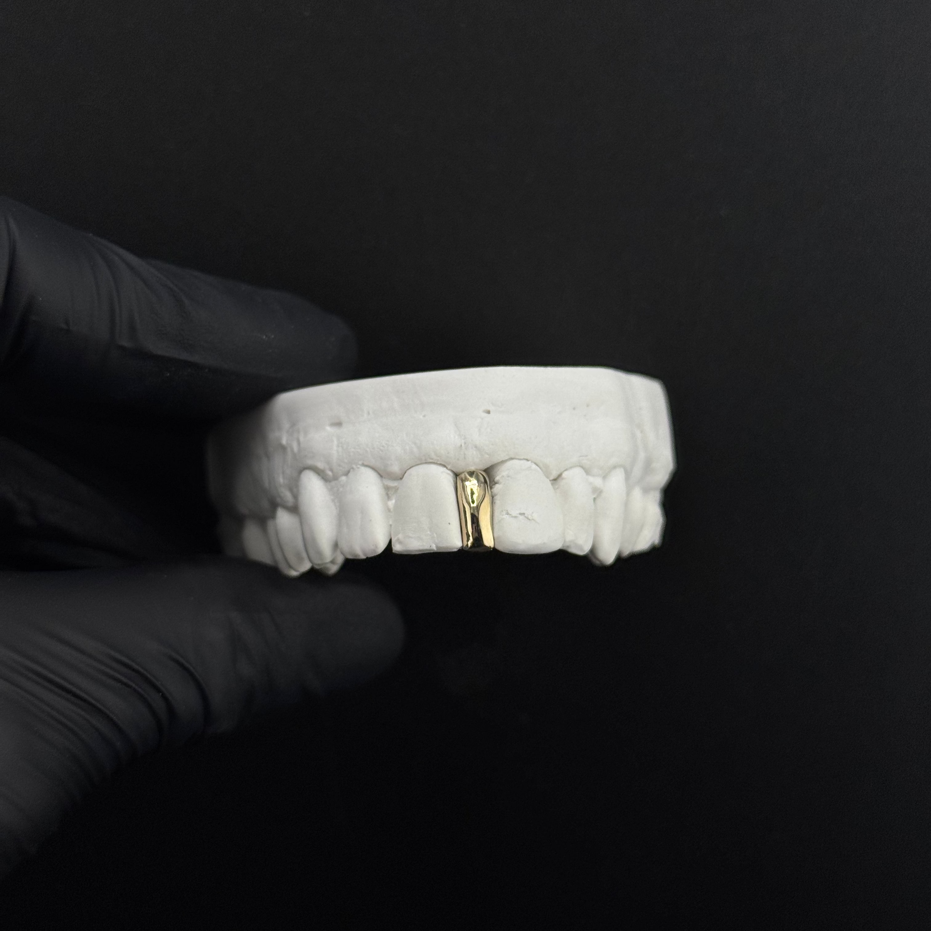 Front Gap – JaeGrills